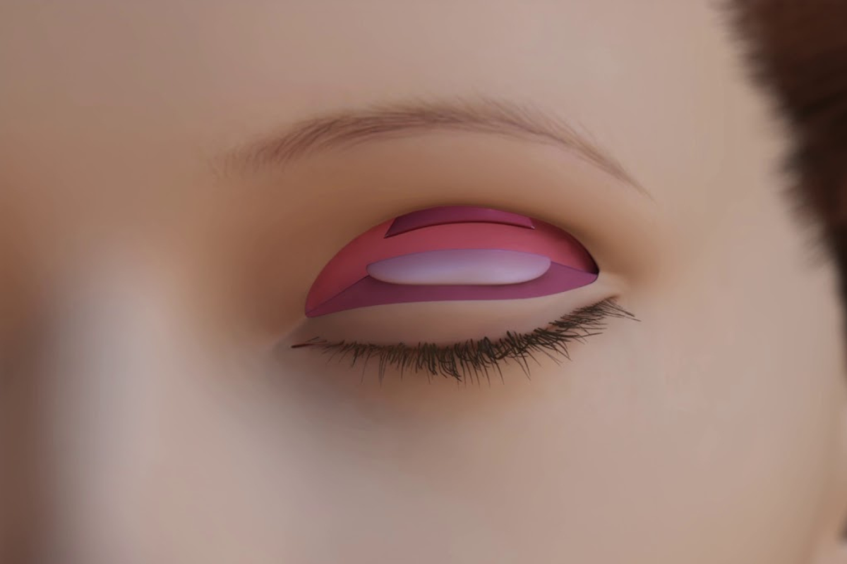 Oculoplasty Surgery in Ahmedabad | Krisha Eye Hospital